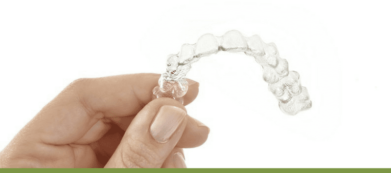 Answers to the Top 10 Invisalign® Questions - Fidler on the Tooth