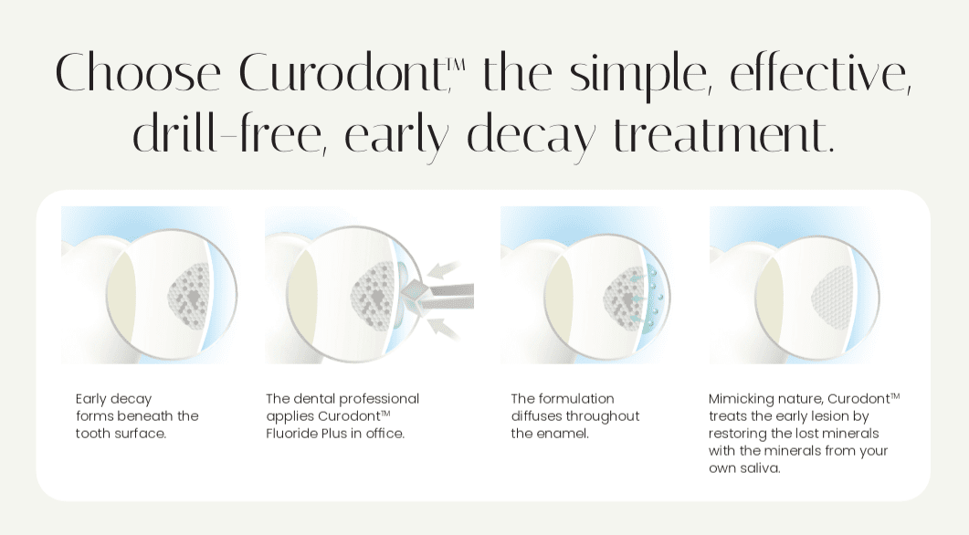 Early Cavities Can Now Be Treated Without a Drill! | Fidler On The Tooth